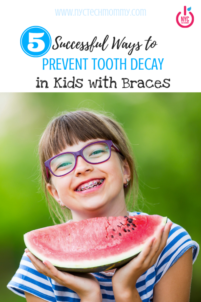 5 Successful Ways to Prevent Tooth Decay in Kids with Braces | NYC Tech ...